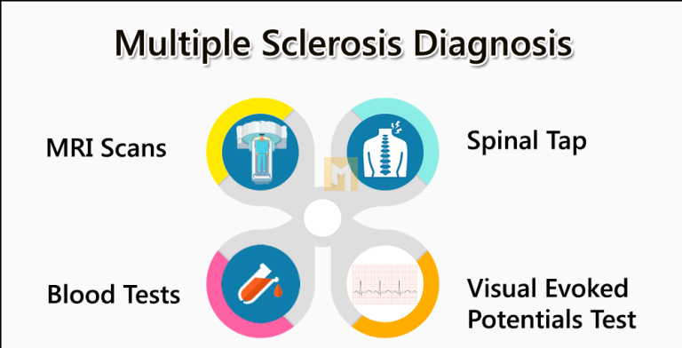 How is multiple sclerosis diagnosed? - Media Review it